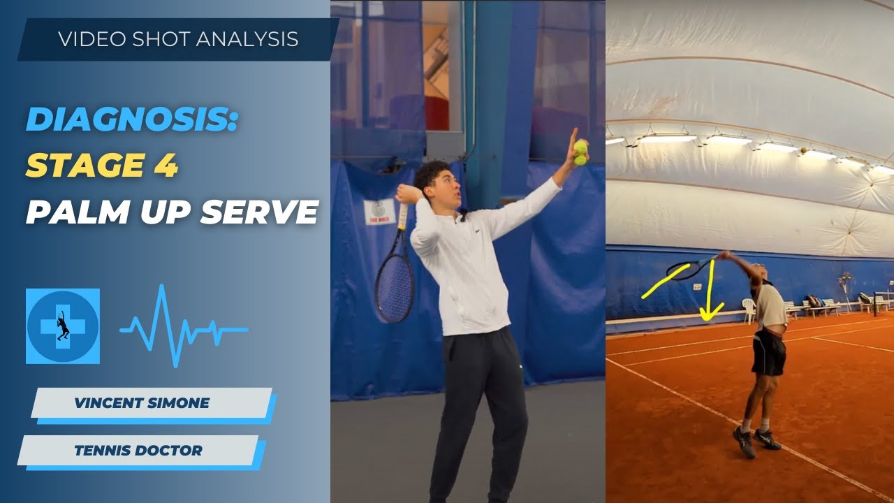 Tennis Doctor Video Diagnosis Clinic: Stage 4 Palm Up Serve - YouTube