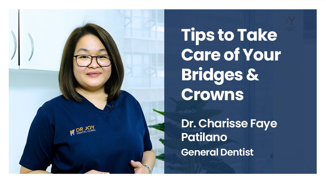 Tips to Take Care of Your Bridges & Crowns - Dr. Charisse - General ...