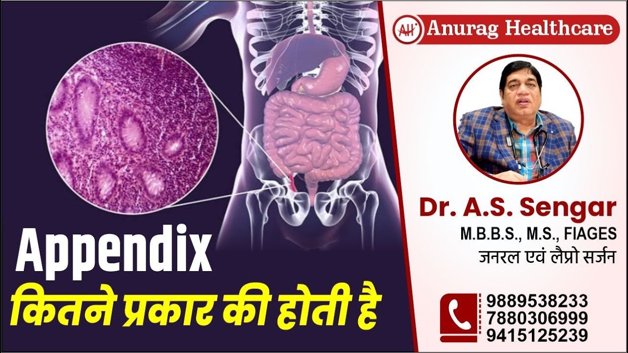 Appendix कितने प्रकार की होती है| (Types of Appendix) | Dr. A.S. Senger ...