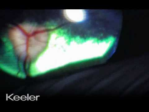 Veterinary Ophthalmoscopy - Dog Retina - YouTube