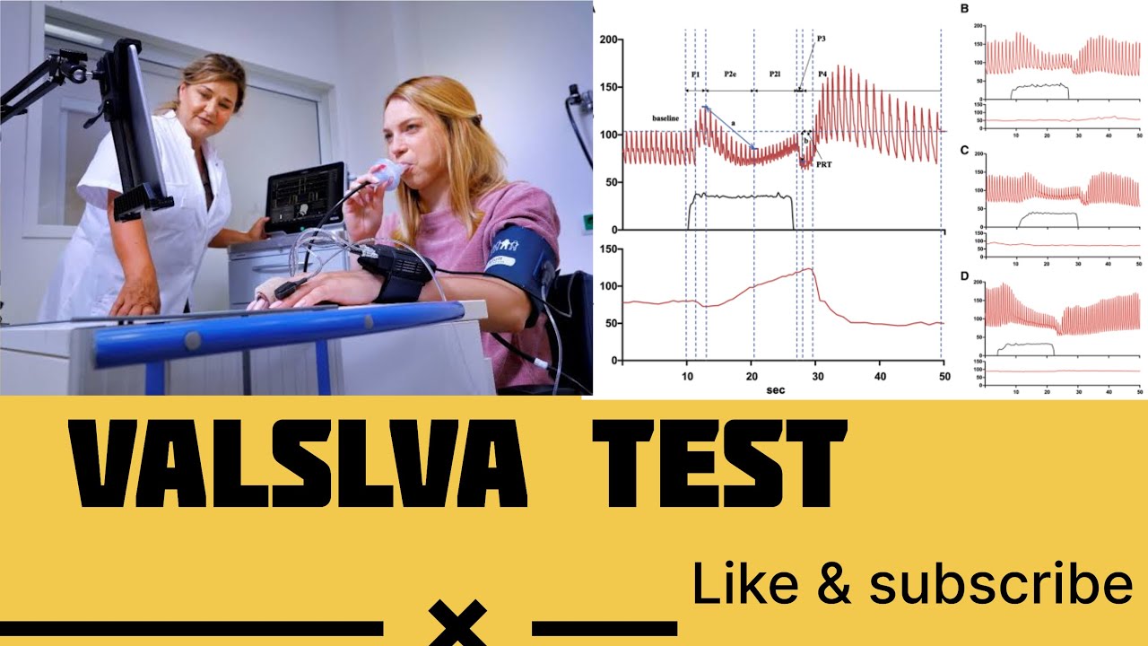 Autonomic functionTest PART -2 ।। VALSALVA TEST | AFMC PUNE neuro Lab ...
