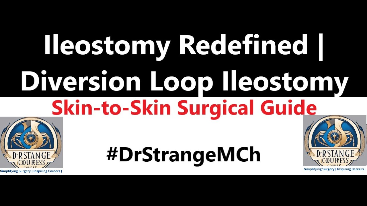 Double Barrel Ileostomy
