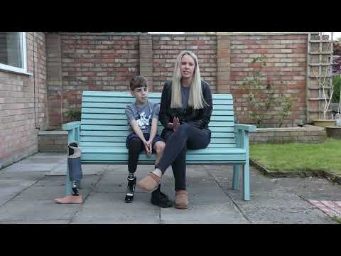 Little Boy Who Lost His Leg Now Models for Famous Brands