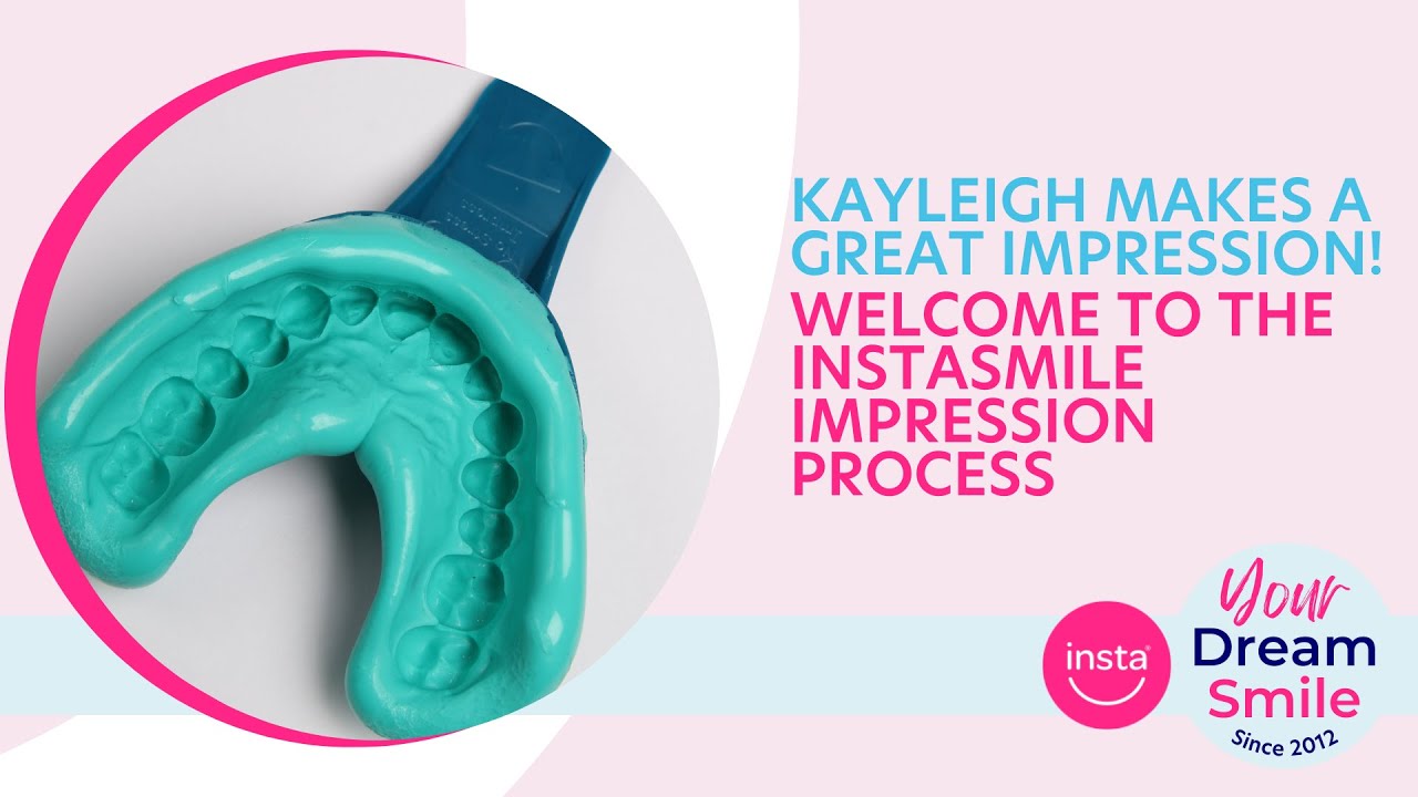 The instasmile, clip in veneer impression process - YouTube
