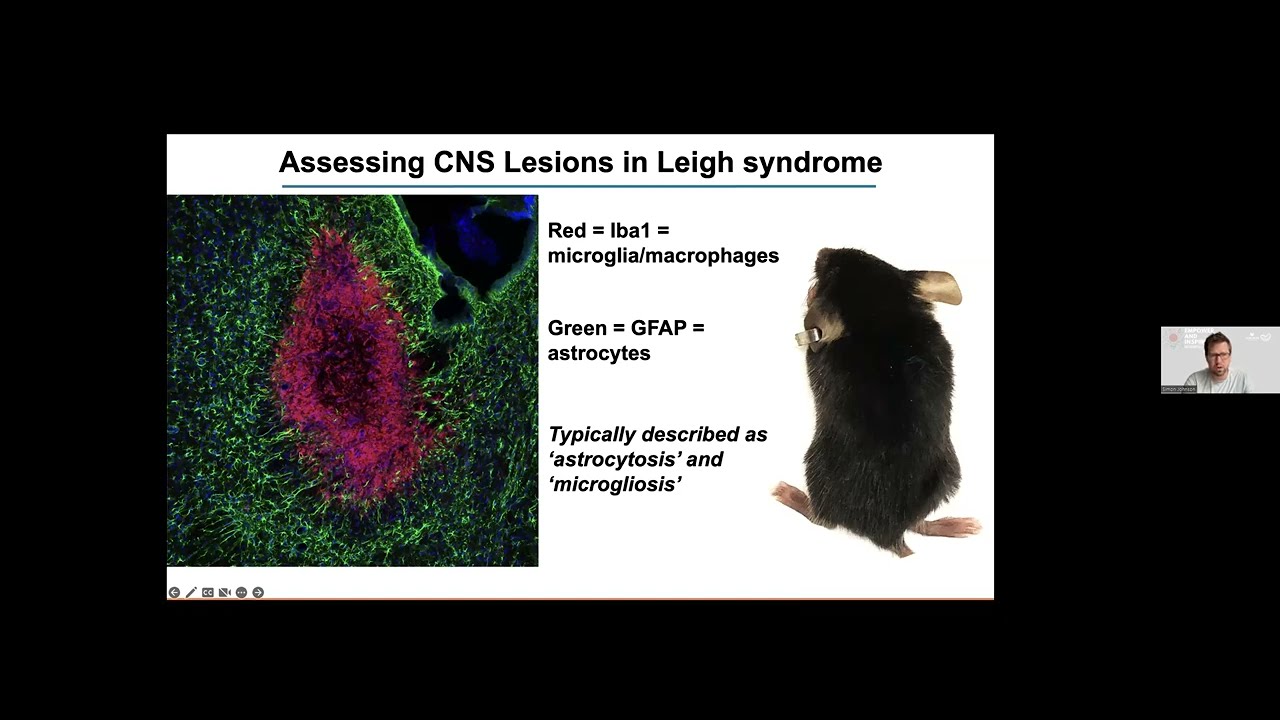Dr. Simon Johnson Immune Mediated Disease Pathogenesis in leigh ...
