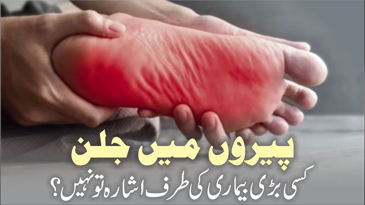 Pairon Ke Talve Mein Jalan Ho To Kya Karen | Dr. Fahad Artani ...