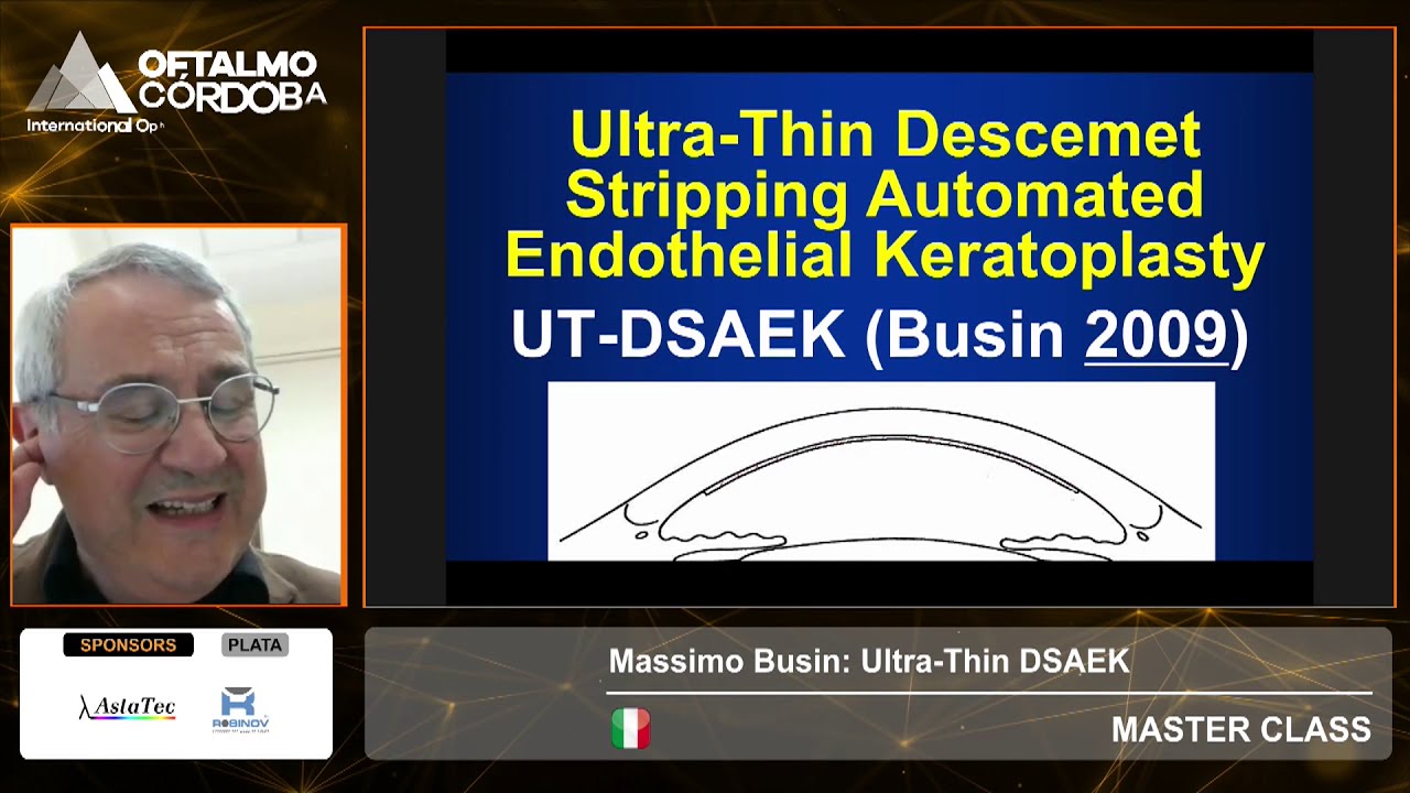 Master Class Prof. Massimo Busin - Ultra Thin DSAEK - YouTube