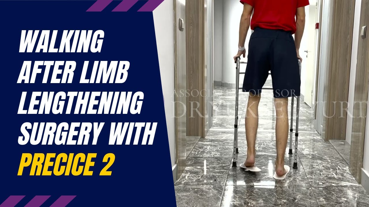 Walking After Limb Lengthening Surgery with Precice 2- Dr.Yuksel ...