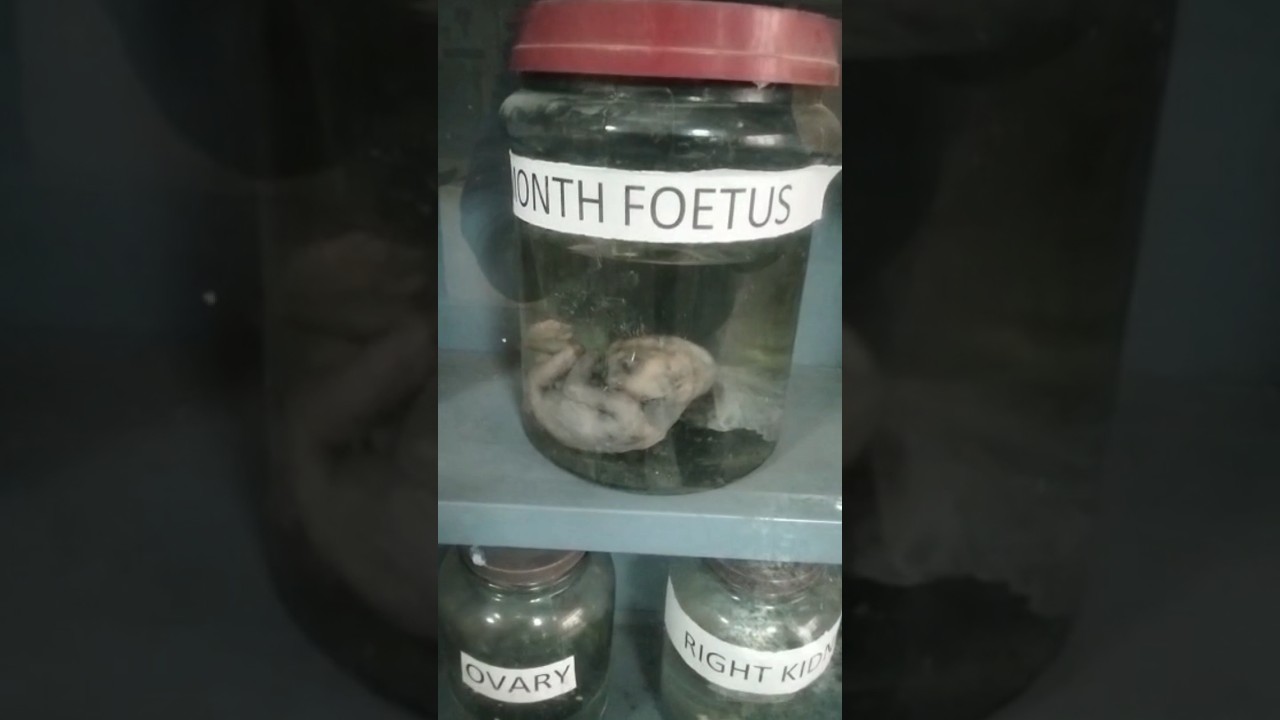 Real foetus in anatomy lab #anatomy #viral #lab #anatomy_physiology # ...