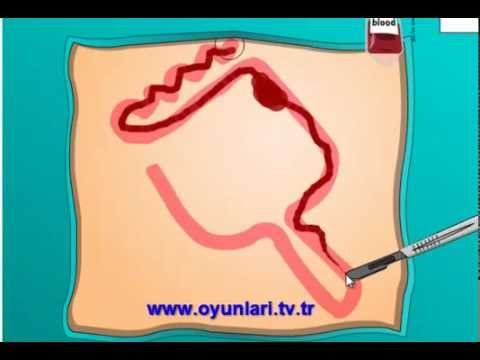 Friv.info.tr - Çeşitli Online Ameliyat oyunu