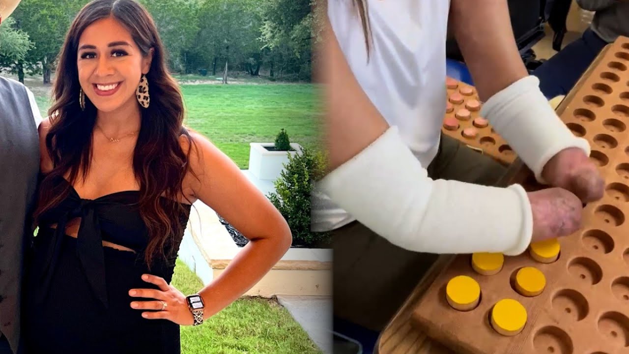 ‘Strength she has amazes me’: Pleasanton mother continues intense rehab after hands, feet ...