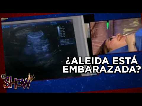 ¿Aleida en espera de bebé? | Es Show
