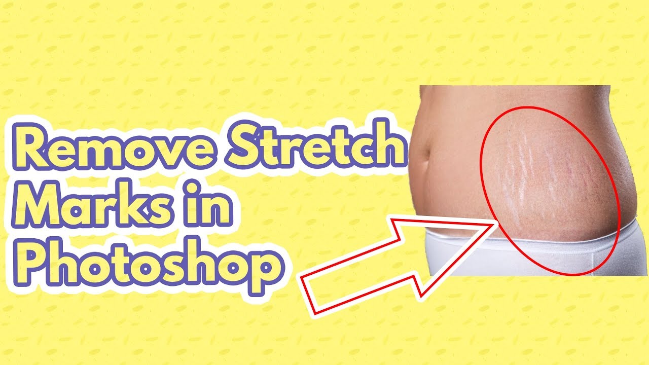 Remove Stretch Marks In Photoshop YouTube remove-stretch-marks-in-photoshop-youtube