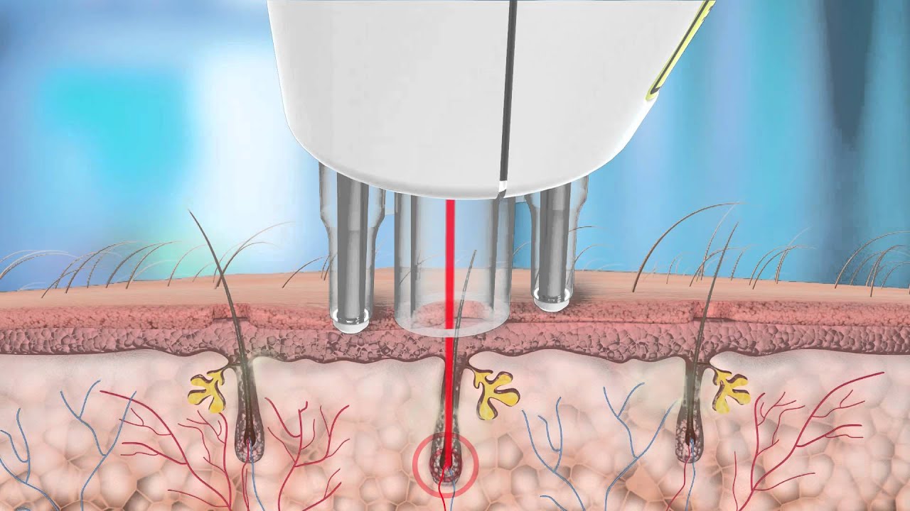 Rio Laser Tweezer Animation - YouTube