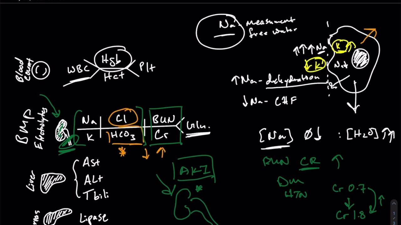 Labs Overview for Chest Pain Virtual Rounds - YouTube