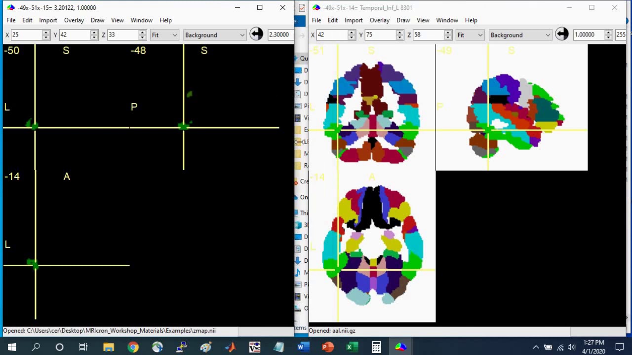 MRIcron Brain Region of Interest (ROI) Guide Part 3 - YouTube