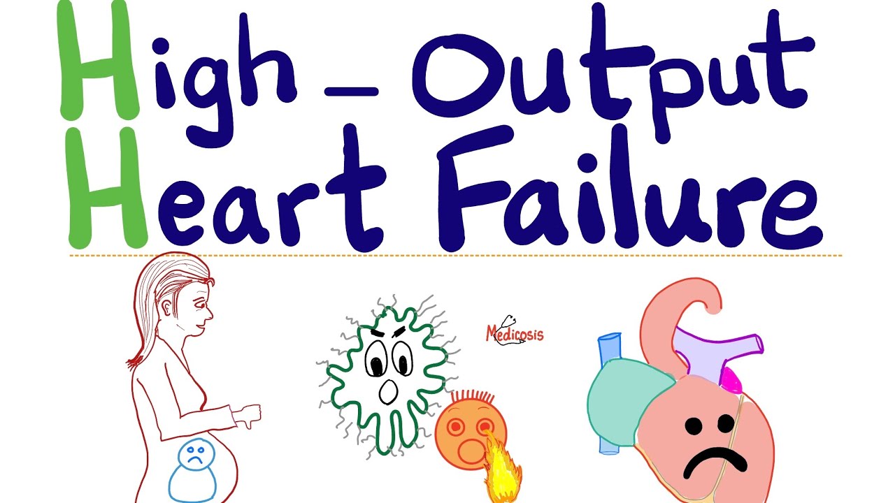 High-Output Cardiac Failure (Hyperdynamic Circulation) | Cardiology ...