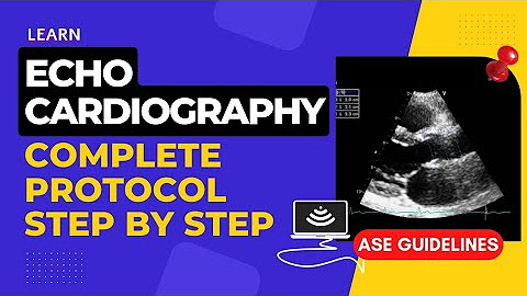 Echocardiography Tutorials #Echo #Echocardiography #Howtodoechocardiography - YouTube