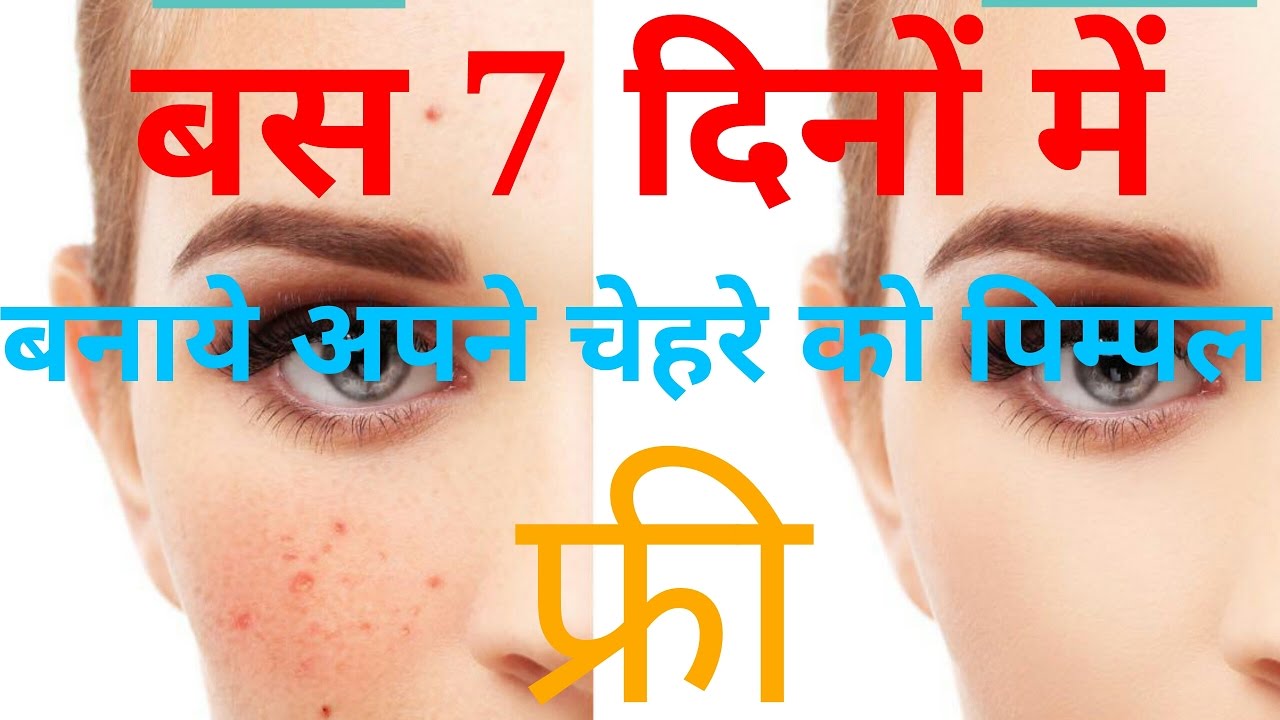How To Make A Face Pimple Free - YouTube