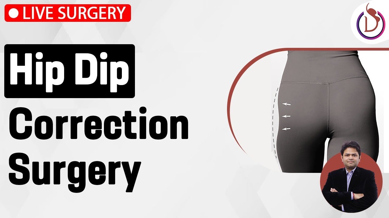Hip Dip Correction Surgery - YouTube