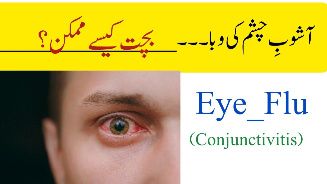 Ashob E Chashm Ka Ilaj In Urdu Eye Infection In Pakistan Youtube