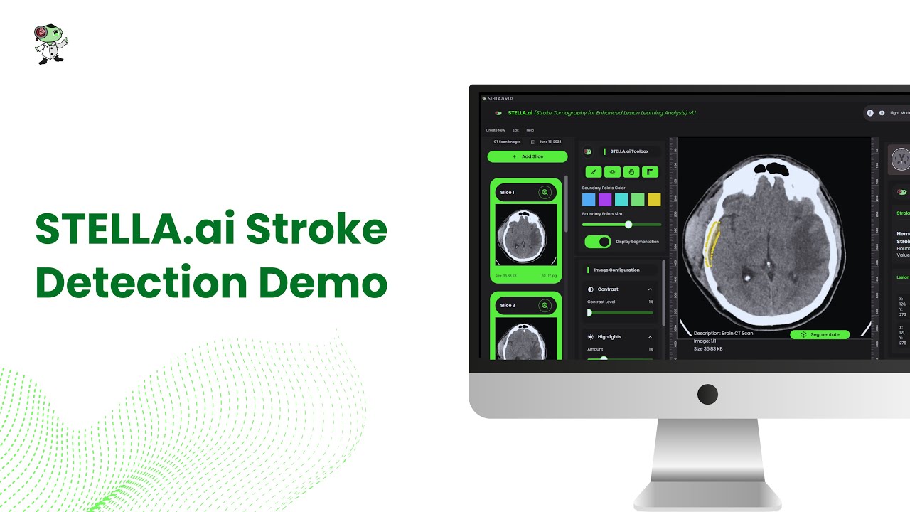 STELLA.ai Stroke Detection Demo - YouTube