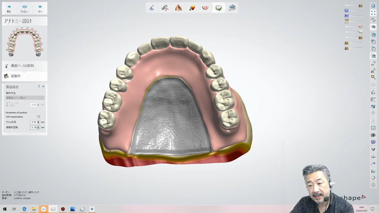 How to make a metal-based full denture with only a completely digital ...