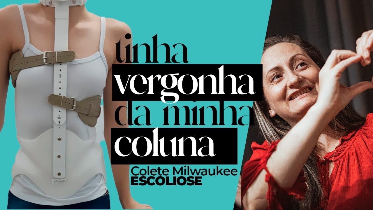 Vergonha da minha coluna | Colete Milwaukee | Escoliose - YouTube