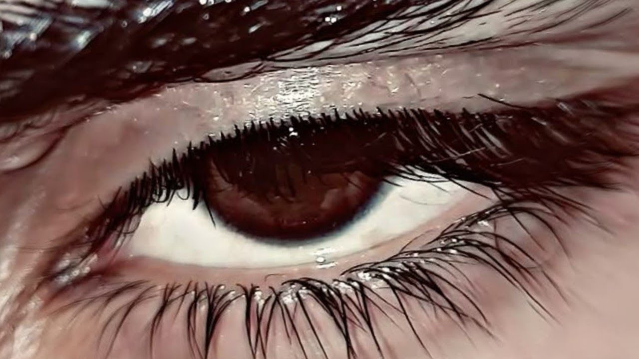 𝐈𝐂𝐄 𝐂𝐎𝐋𝐃 𝐒𝐓𝐀𝐑𝐄 – 𝐇𝐔𝐍𝐓𝐄𝐑 𝐄𝐘𝐄𝐒 𝐒𝐔𝐁𝐋𝐈𝐌𝐈𝐍𝐀𝐋 | 𝐍𝐎 𝐌𝐄𝐑𝐂𝐘 - YouTube