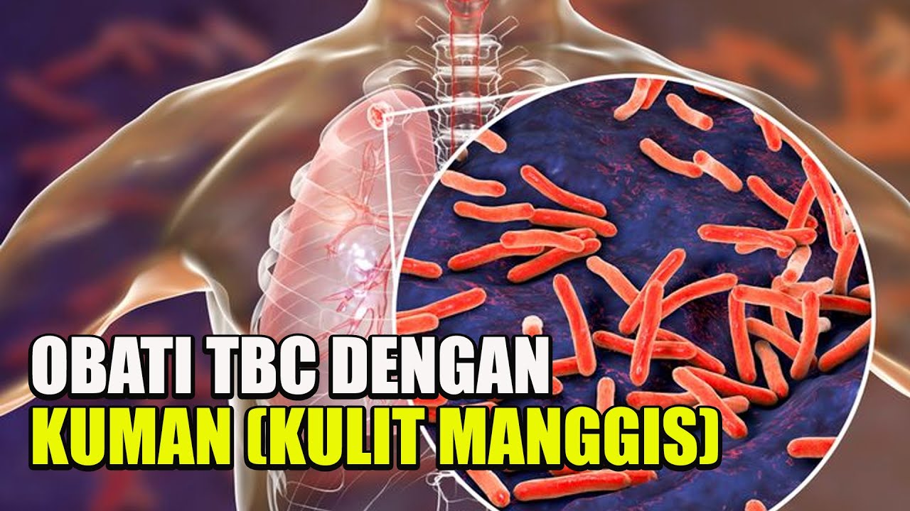Pengobatan TBC dengan KUMAN (Kulit manggis) - YouTube
