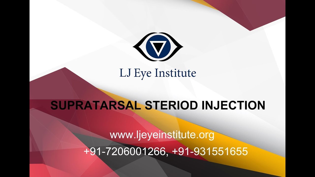Supratarsal Steroid Injection - LJ Eye Institute - YouTube
