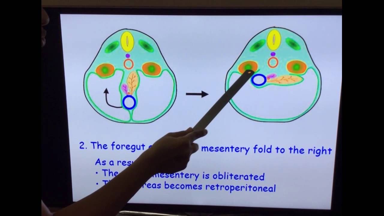 Embryology of GIT Part III - Development of Liver and Pancreas by Dr ...
