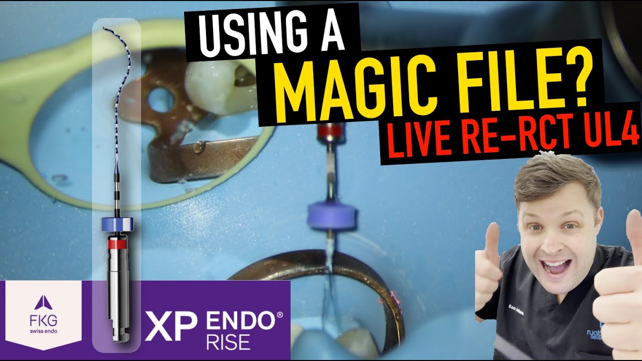 XP-Endo Finisher in Action: Mastering Retreatment on a Tough Upper ...