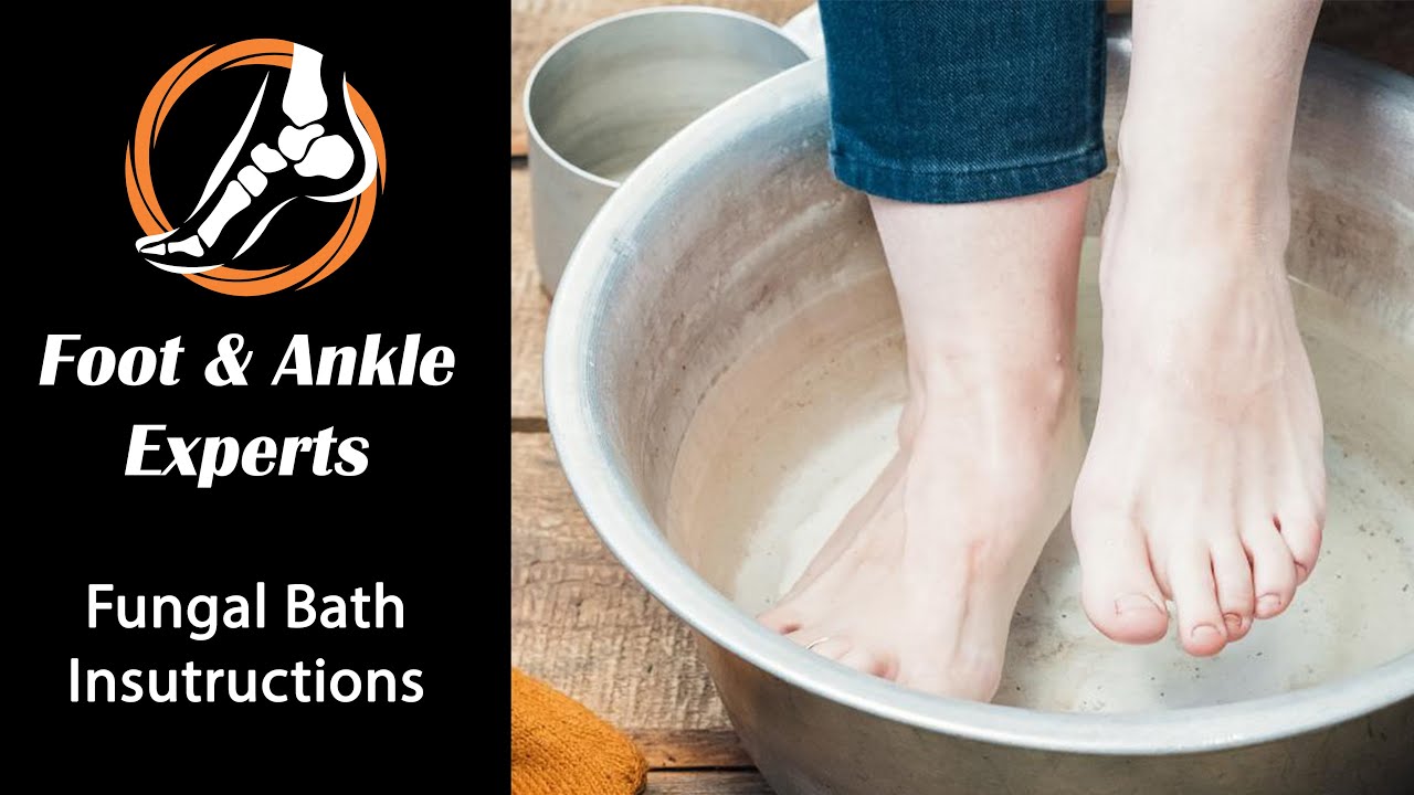 Fungal bath instructions - YouTube