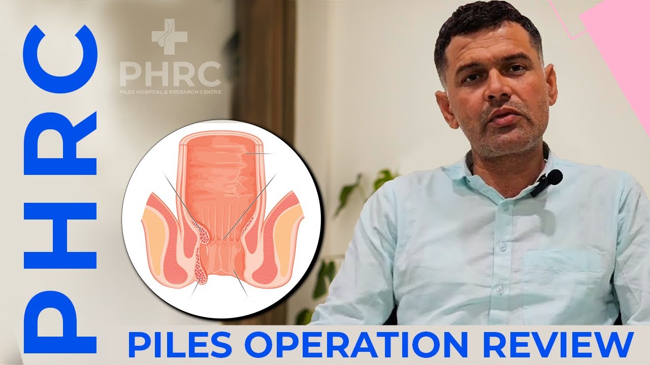 Piles Operation Review: Patient's Honest Experience #viral #piles - YouTube