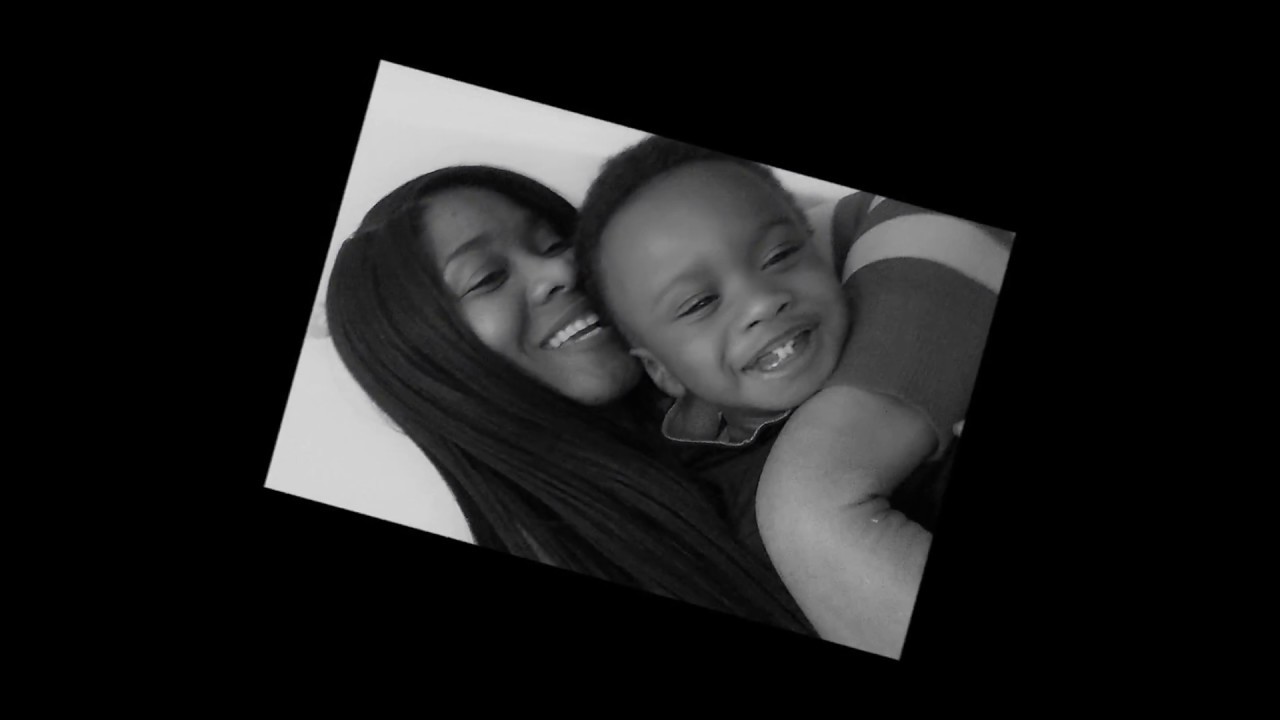 My Son has Hypospadia with Chordee - YouTube
