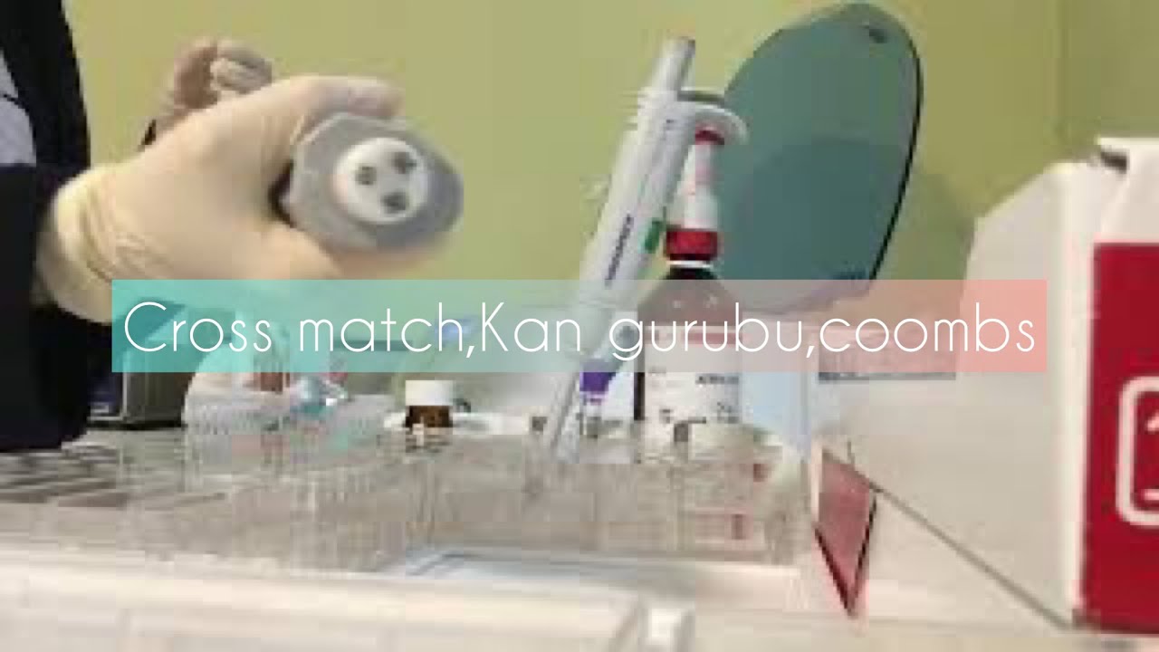 Cross Match Neden Yapılır? Nasıl Yapılır? Kan grubu ve Coombs Nasıl ...