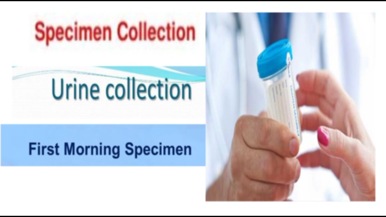 Urine sample collection method || Urine Specimen Collection From The ...