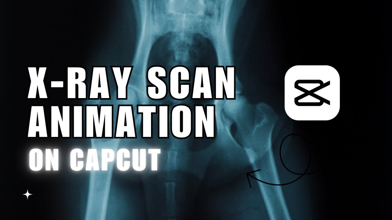 How To Create This X-Ray Scan Animation For Your Video Edits In CapCut ...