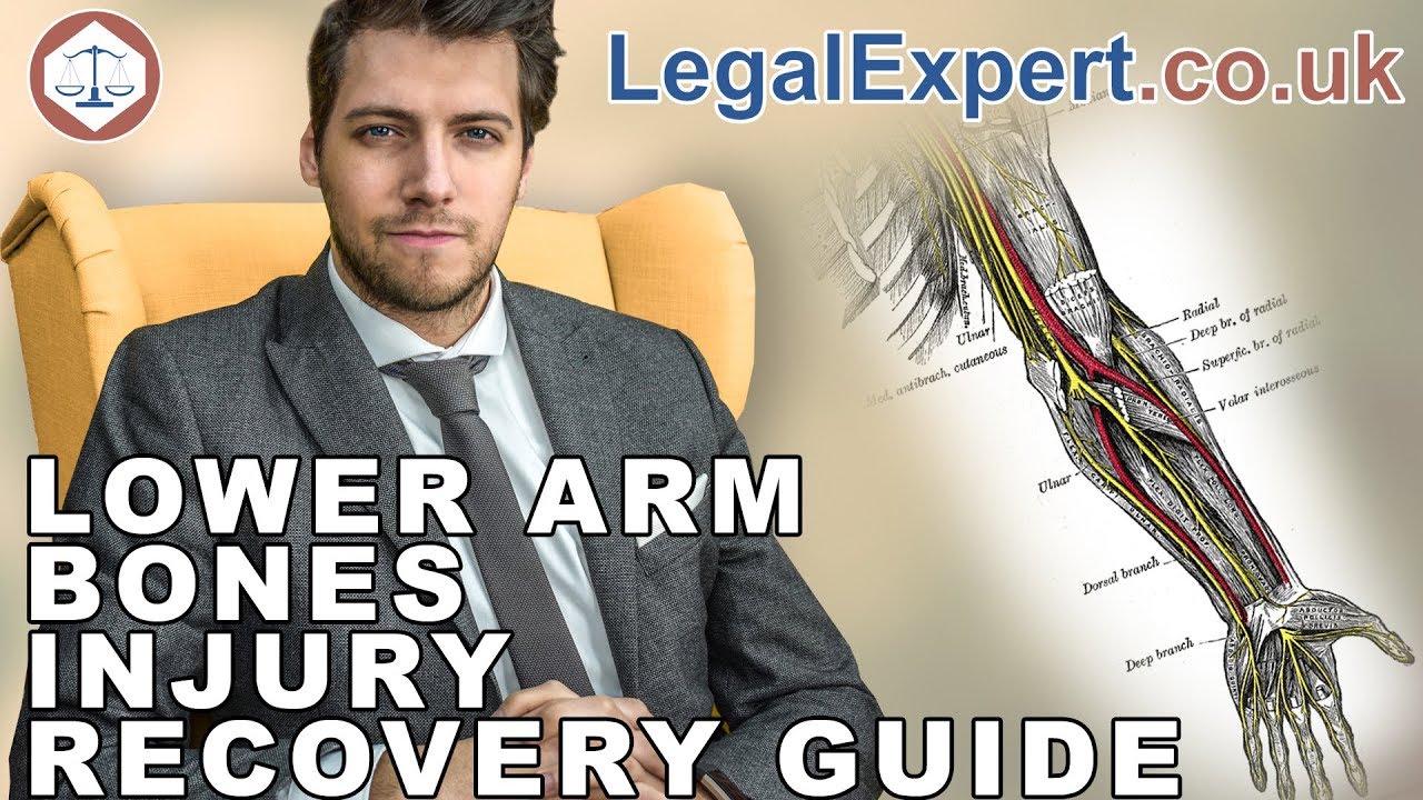 Lower Arm Bones Injury Recovery Guide ( 2019 ) UK - YouTube