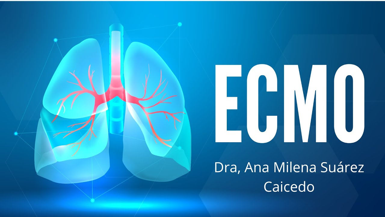 Cuidado diario del paciente en ECMO - YouTube