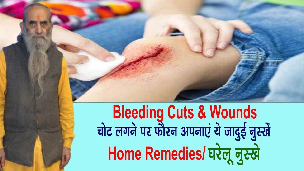चोट लगने पर फौरन अपनाएं ये उपचार ||Bleeding Cuts & Wounds || Home ...