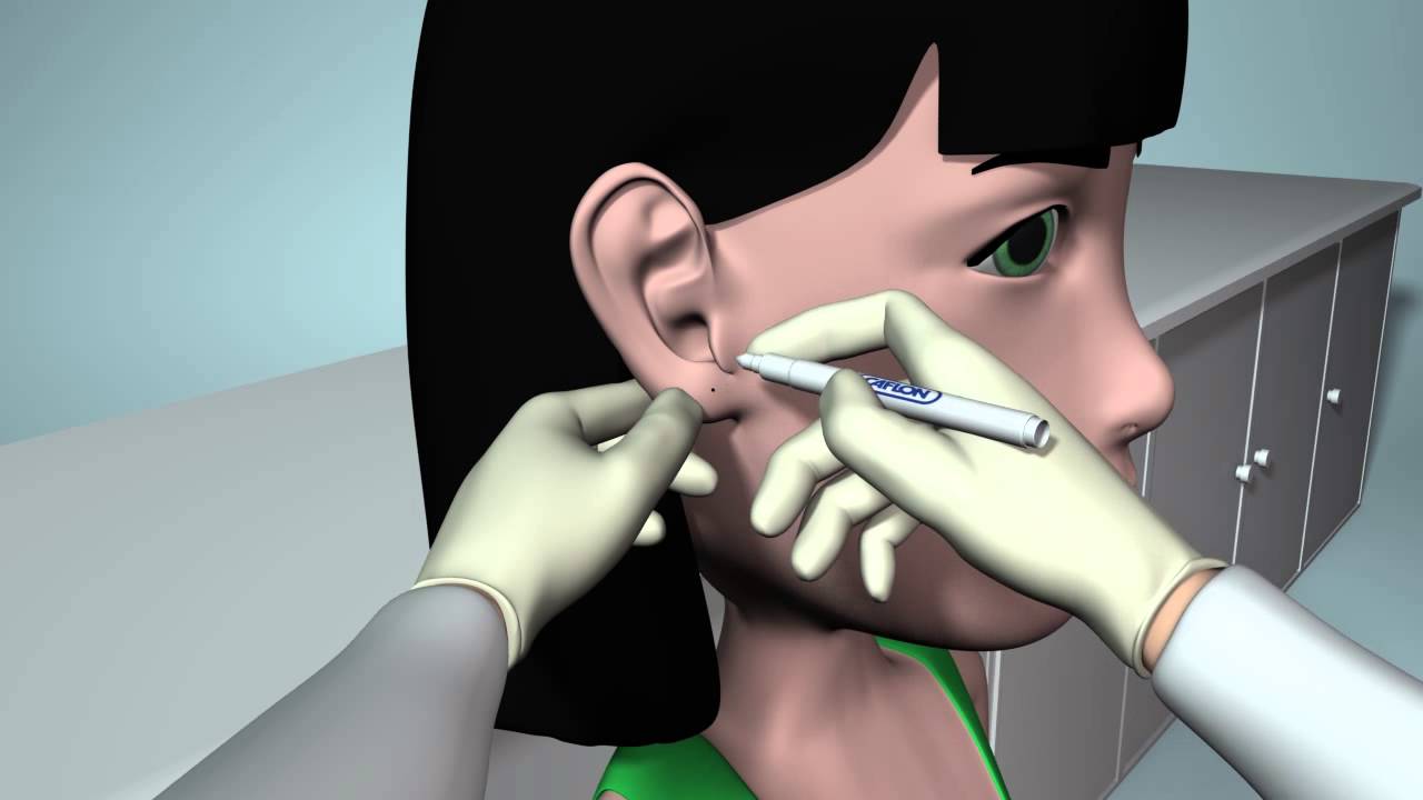 Caflon Original Training Video - YouTube