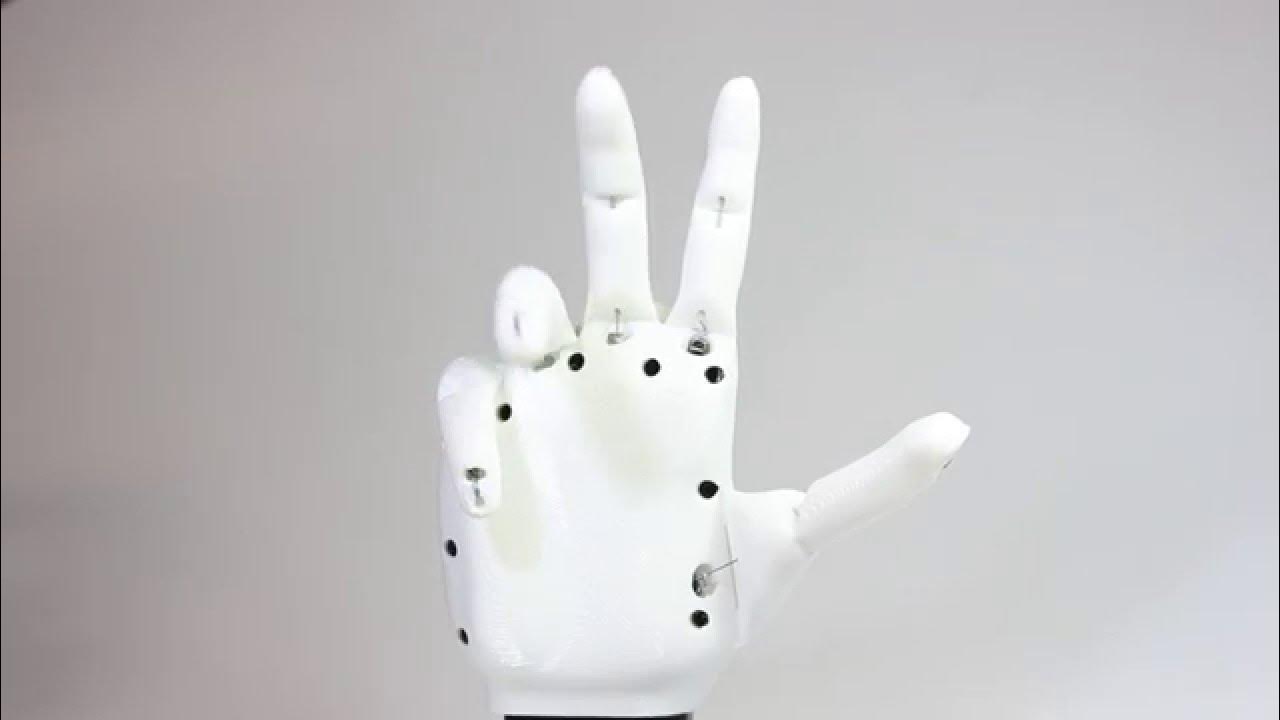 Open Bionics Ada Robotic Hand Controllable Via EMG - YouTube
