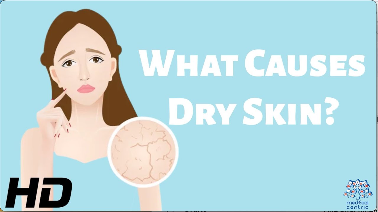 Say Goodbye to Dry Skin: Exploring the Root Causes and Solutions - YouTube