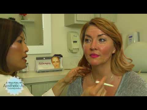 Sculptra with Dr. Maya Kato