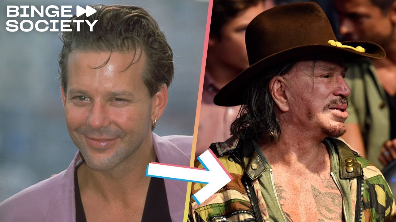 Actors Who Had Plastic Surgery | Then vs. Now - YouTube