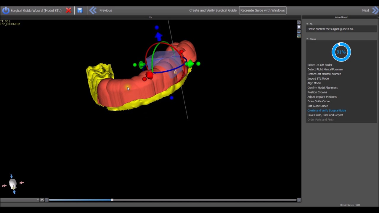 Creating a Window in a Surgical Guide - YouTube