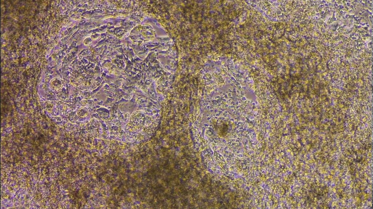 Beating Heart Muscle Cells Derived From Human Stem Cells - YouTube