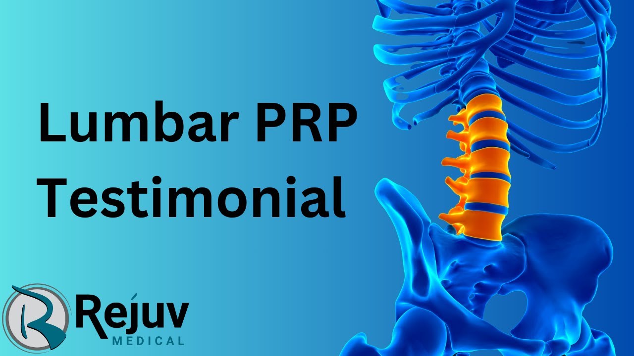 Lumbar PRP Testimonial // Rejuv Medical - YouTube